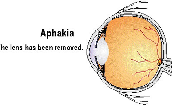 Diseases Archives - SIMS